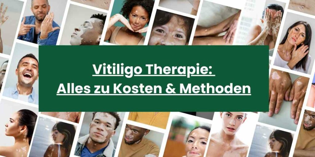 Vitiligo Therapie: alles zu Kosten & Methoden - Vitiligo-Zone.de!